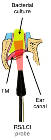 Ear imaging | Biophotonics Imaging Laboratory | UIUC