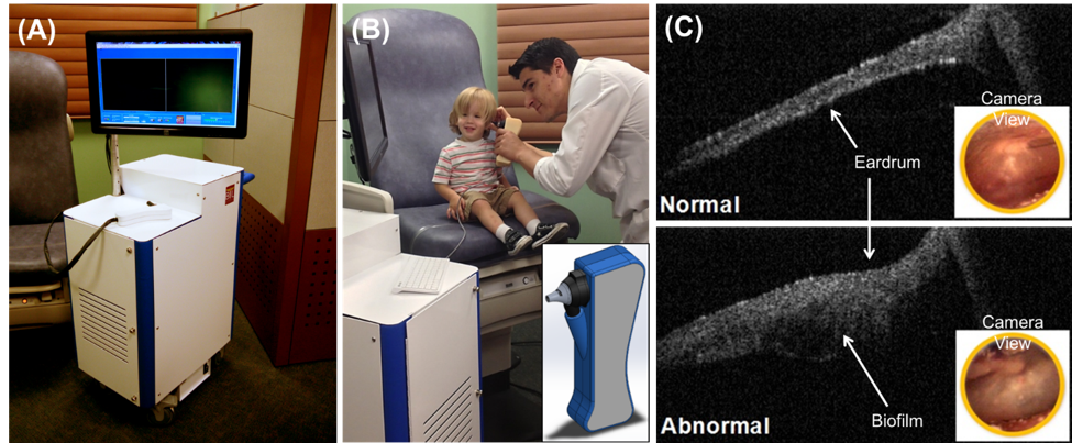Ear imaging | Biophotonics Imaging Laboratory | UIUC