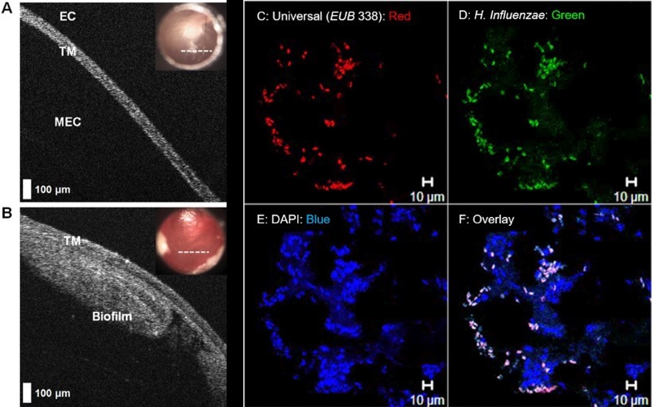 Ear imaging | Biophotonics Imaging Laboratory | UIUC