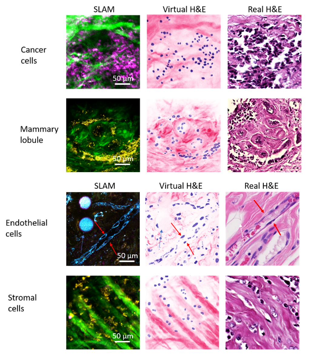 AI-driven optical imaging | Biophotonics Imaging Laboratory | UIUC